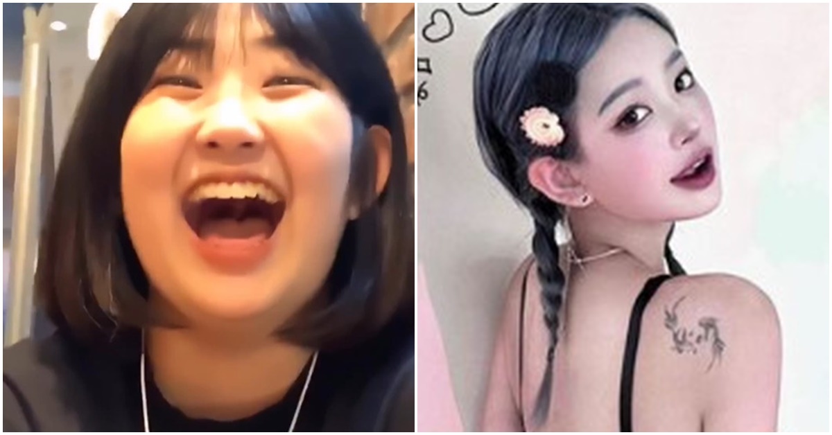 현재 44kg… 날씬하다 못해 깡마른 유명 셀럽, 96kg 시절 전격 공개 | 위키트리