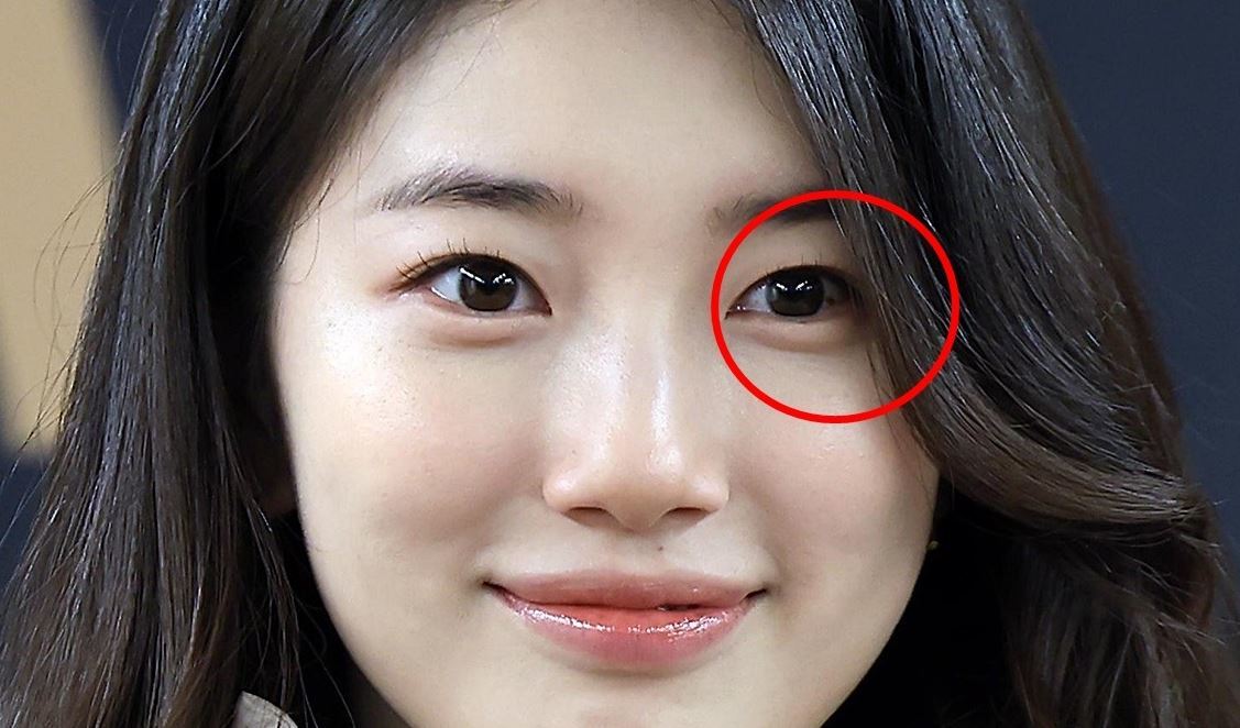 Suzy Reveals Her Recent Surgery, Here’s What You Didn’t Know | 위키트리